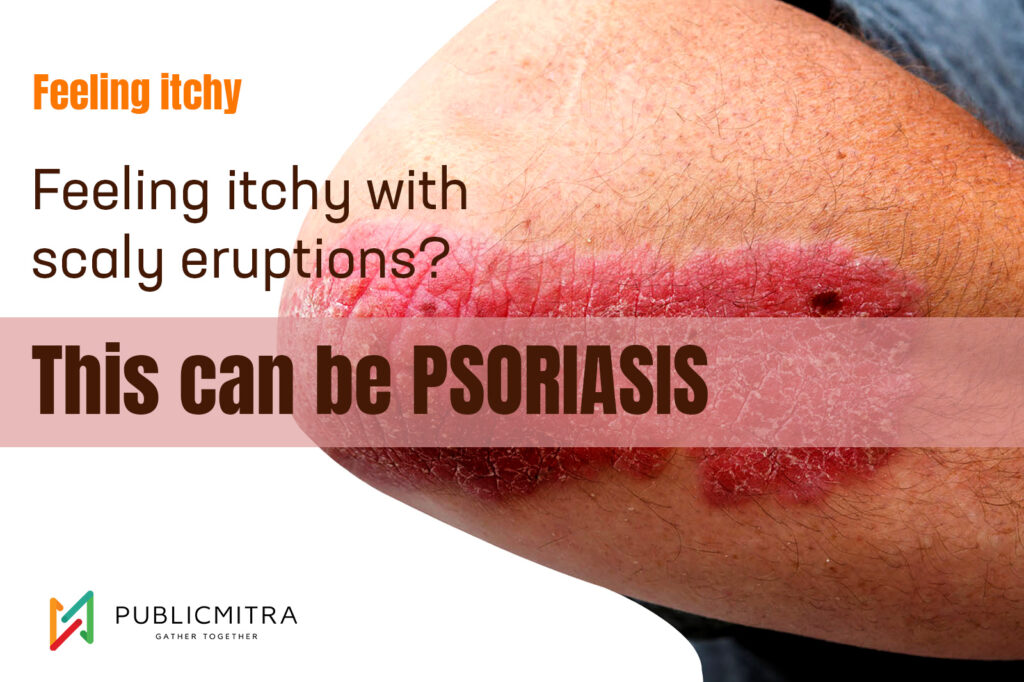 Itchy Skin Condition - Psoriasis